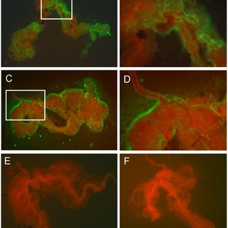 Yellow Fever - PLOS Collections
