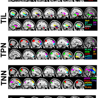 Brain Mapping Methods: Functional MRI - PLOS Collections