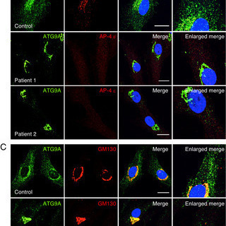 PLOS Genetics Top 10% - PLOS Collections